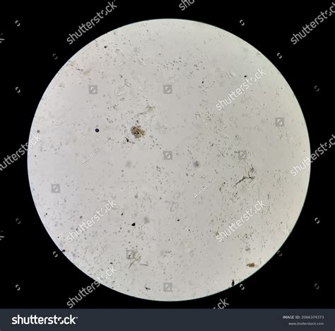 Urine Microscopy Labeled