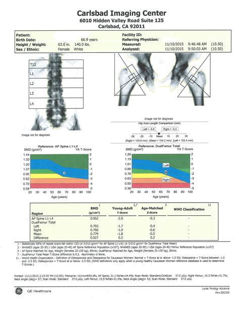 Osteoporosis Fracture Lumbar Icd 10