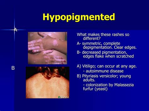 Ppt Dermatology For Out Patient Internal Medicine Powerpoint