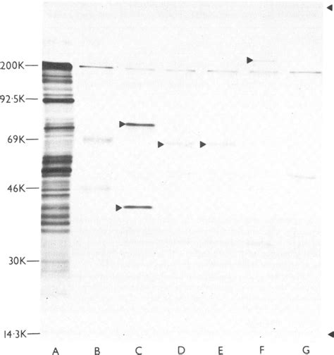 Fluorogram Of 35s Metabolically Labelled P Knowlesi Antigens Separated