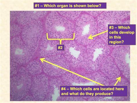 Reproduction Histology Flashcards Quizlet
