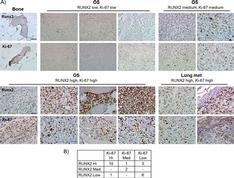 Microrna 34c Inversely Couples The Biological Functions Of The Runt Related Transcription Factor