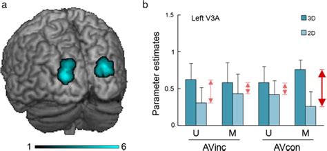 Anatomical Location And Estimated Pattern Of Activity In Visual Area