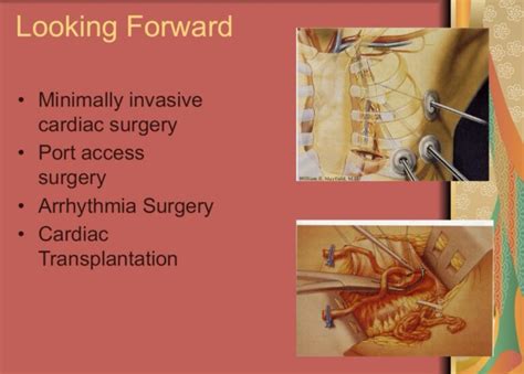 Cardiothoracic And Vascular Surgery Ctvs Rajiv Gandhi Super