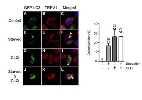 Starvation Augments The Colocalization Of Gfp Lc3 With Trpv1 Al