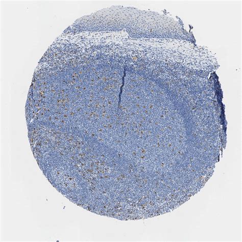 Tissue Expression Of Cd68 Staining In Tonsil The Human Protein Atlas