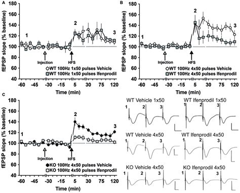 Antagonism Of Glun2b In Freely Behaving Wt Mice Prevents Ltp 2 H But Download Scientific
