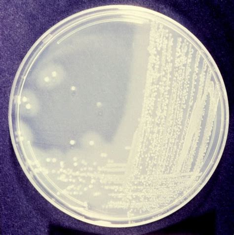 Free Picture Gelatin Agar Identification Bacteria Vibrio Cholerae Causal Agent Cholera