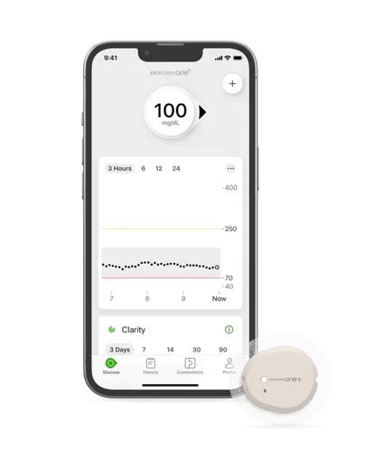 The New Dexcom One Dexcom