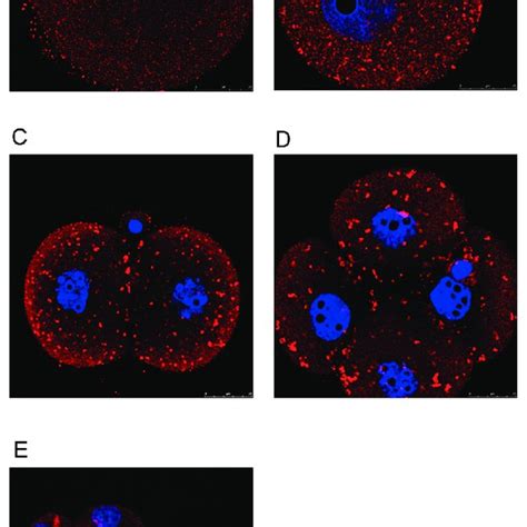 Ovarian Localization Of Epac And Rap1 Proteins Determined By