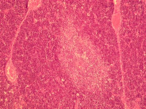 Thymus Slide Wikilectures