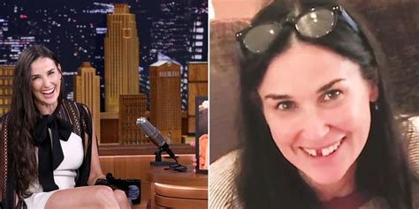 Demi Moore Says She Lost Both Of Her Front Teeth Due To Stress Self