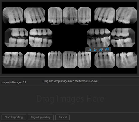 Fmx Dental X Ray Guide Pipih