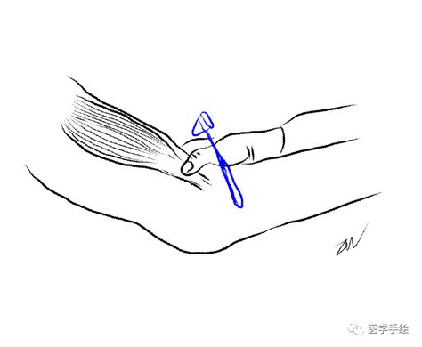 实用技巧：颈部、腰骶部相关的神经根定位！ 德医医学 助力医学教育发展！