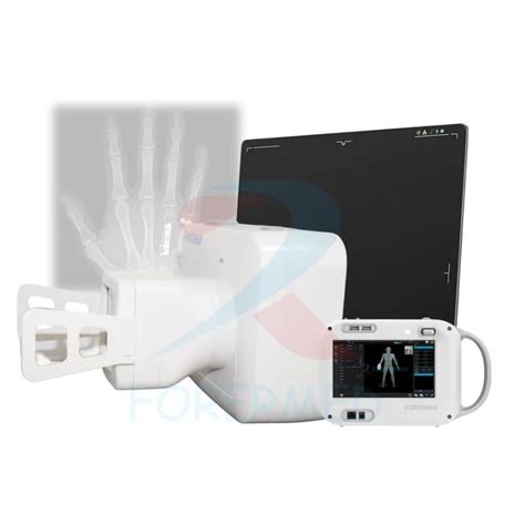 Handheld X Ray Machine Digital X Ray Fluoroscopy Machine X Ray And Xray Machine