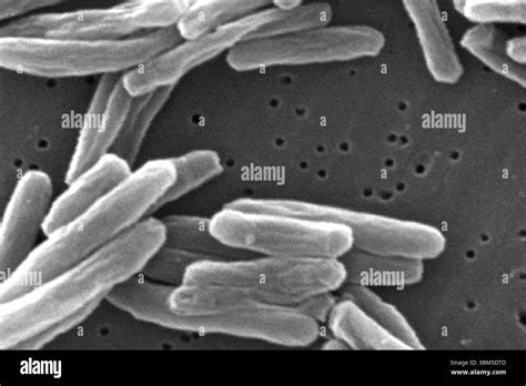 File This 2006 Electron Microscope Image Provided By The Centers For Disease Control And