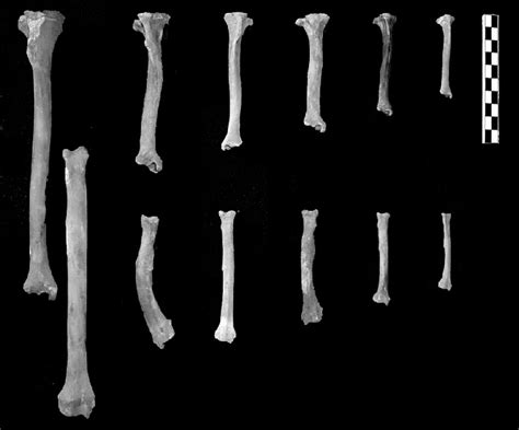 Radius En Bas Et De Tibias En Haut Appartenant à Différents