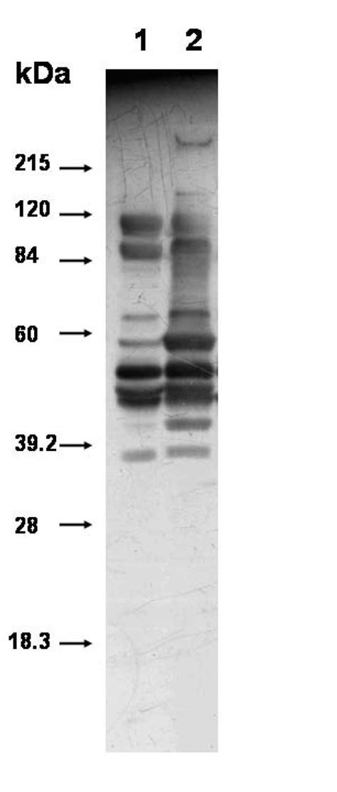 Western Blot Analysis Of Immunogenic Proteins Of Whole Cell Lysate Of