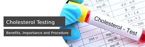 Cholesterol Testing Benefits Importance Procedure Cost Of Cholesterol Test