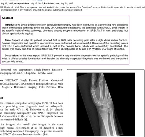 X Ray Of 2011 Of The Right Wrist After Proximal Row Carpectomy Download Scientific Diagram
