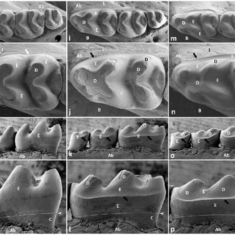 Protrusive Interference And Lack Of Anterior Guidance Download
