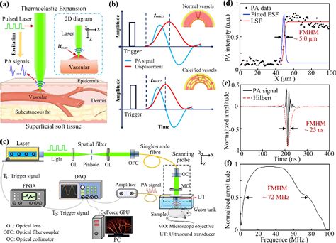 Figure 1 From Monitoring Of Microvascular Calcification By Time