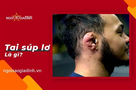 Tai Súp Lơ Là Gì Phương Pháp Cải Thiện Tình Trạng