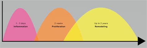 Dextrose Prolotherapy Samvedna Pain Clinic