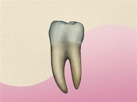 How To Get Rid Of Cavities Without Fillings Is It Possible Self