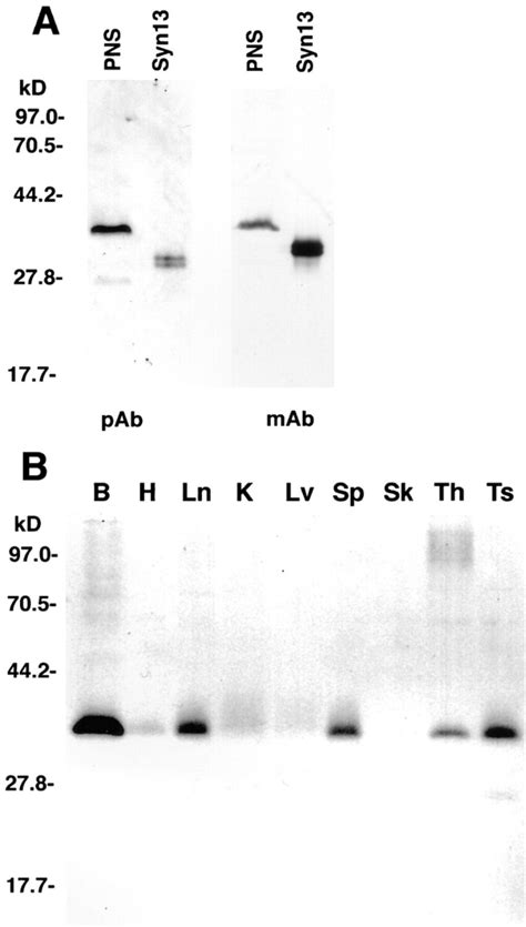 Syntaxin 13 Is A Broadly And Differentially Expressed Snare Protein