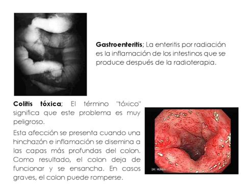 Gastrienteritis Y Colitis Cronica Pdf