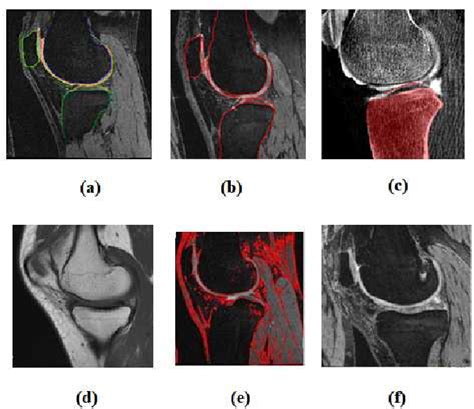 Figure 4 From Space Invariant Artificial Neural Network Based