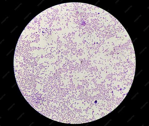 Premium Photo Staphylococcus Aureus Bacteria Colonie Gram Stain