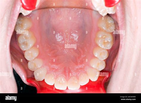 Healthy Teeth View Inside The Mouth Of A Healthy 21 Year Old Woman Showing Her Teeth Stock