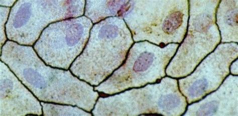 Squamous Epithelial Tissue