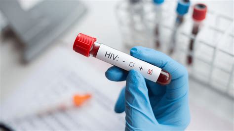 Cuál Es La Diferencia Entre Sida Y Vih Farmacias Roma