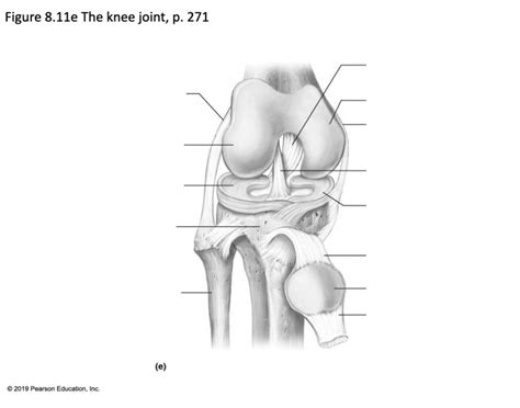 Swiger Knee Joint — Printable Worksheet