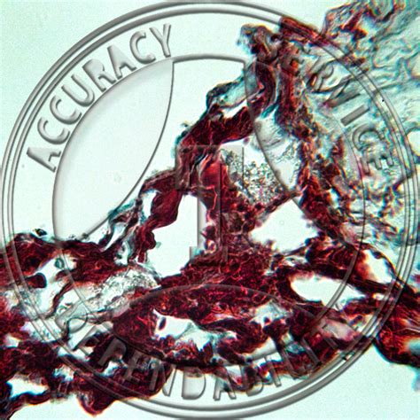 Cercospora Beticola Prepared Microscope Slide