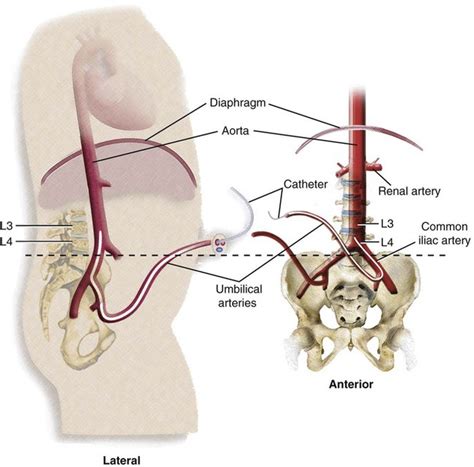 Vascular Anatomy Of The Pelvis Radiology Key