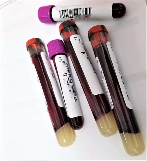 Ascp Phlebotomy Certification Is It Worth It In 2024