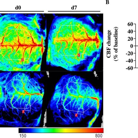 Bilateral Carotid Artery Stenosis Led To A Persistent Decrease In Download Scientific Diagram