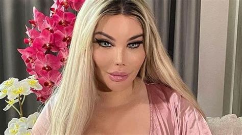 Jessica Alves Former Human Ken Doll Has ‘new Vagina After Gender Reassignment Surgery Daily