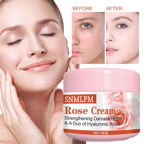 Yoweipon Face Cream Skin Care Removal Ointment And Cream Mark And