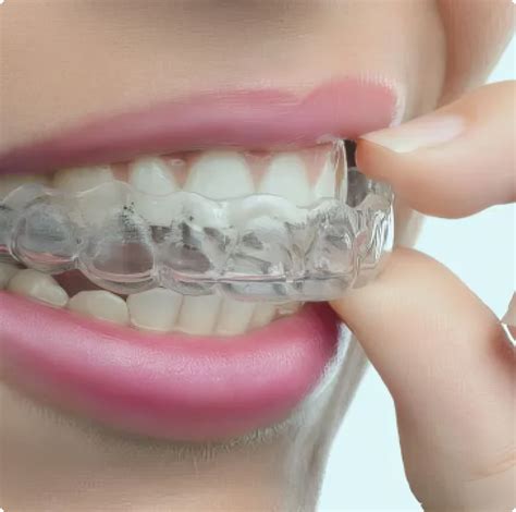 Clear Correct Braces In Anchorage Ak Delaney Park Dental