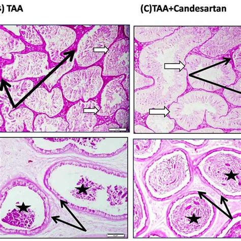 Sections Of Rat Testis And Cauda Epididymis Stained By Pas A Normal Download Scientific