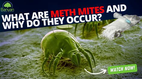 Meth Bites Skin Condition Meth Bites Skin Condition