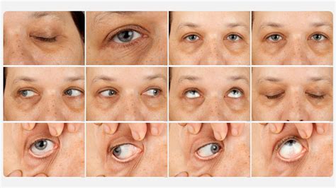 Ada High Res Skin Texture Photo Set 2d Graphics Levius