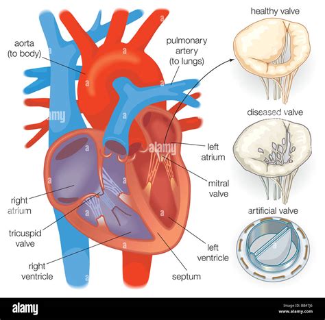 Anatomie De La Valve Cardiaque Humaine Endocardite Diagnostic Et