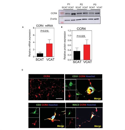Ccr4 Expression Is Increased In Vcat From Morbid Obese Patients A Download Scientific