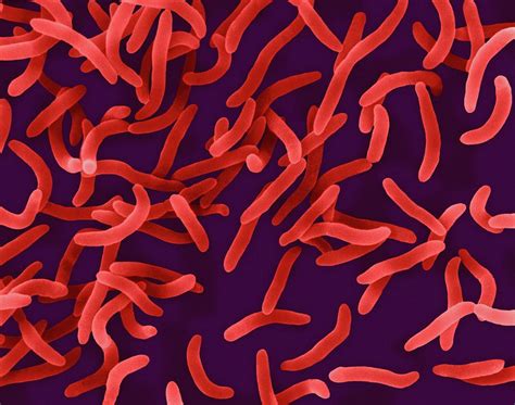 Vibrio Cholerae Microscope